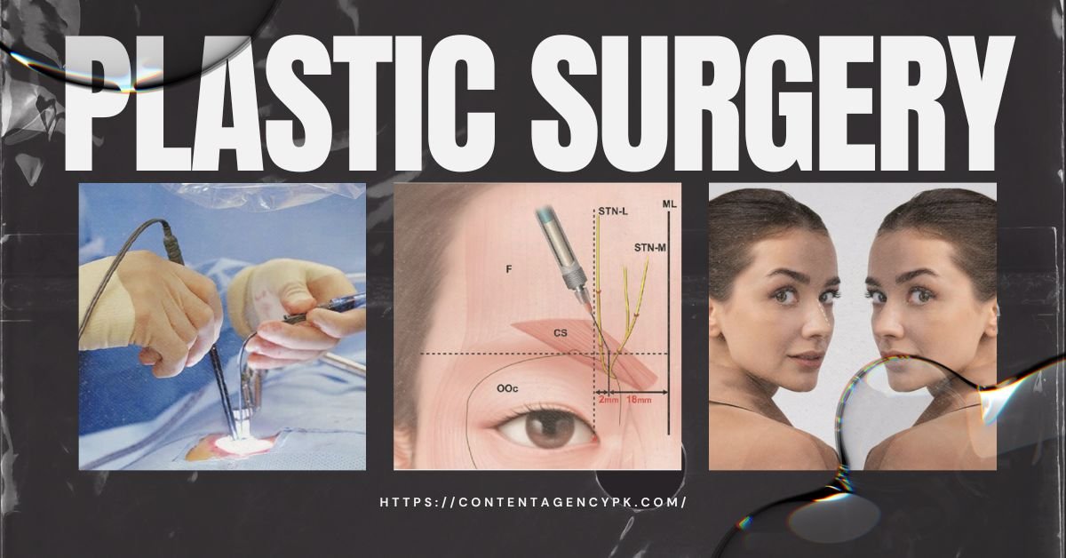 WHAT IS PLASTIC SURGERY? - Content Agency Pk